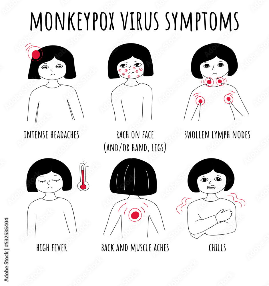 Monkeypox virus doodle symptoms set. Girl with symptoms new viral ...