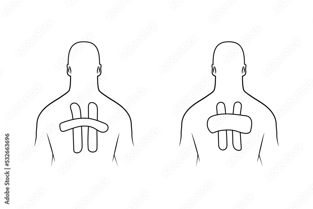 Poster Kinesiology therapeutic sports tape on thoracic spine sketch ...