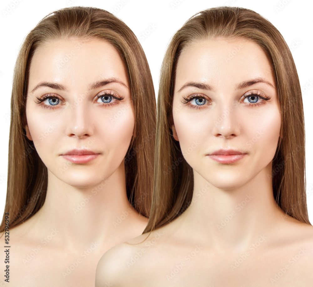 Woman before and after cheekbones shape correction. Stock Photo | Adobe ...