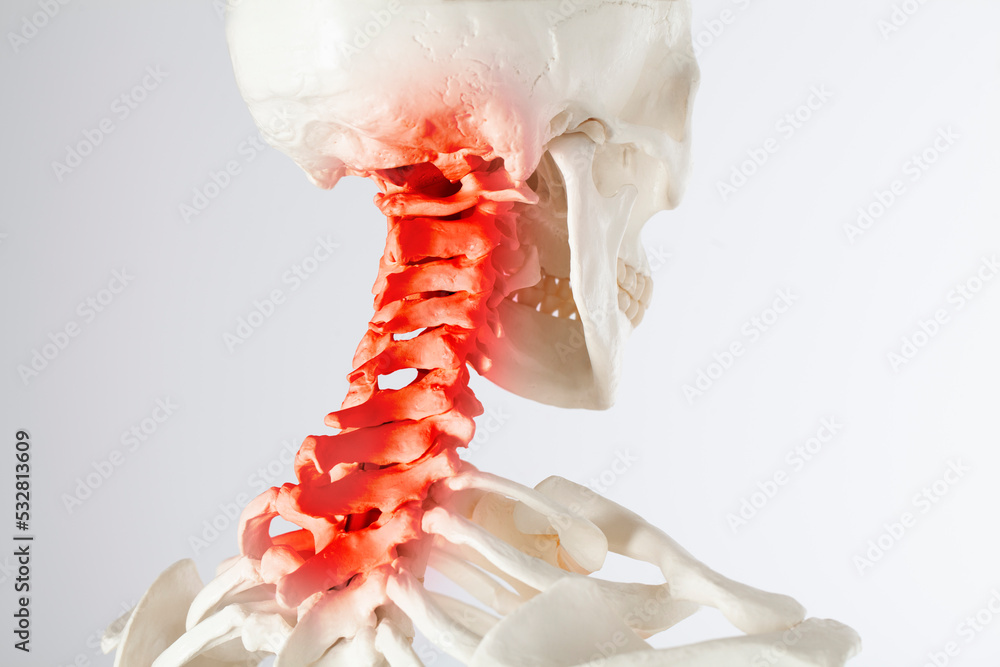 Human body upper spine and neck pain zone, atlas vertebrae and cervical ...