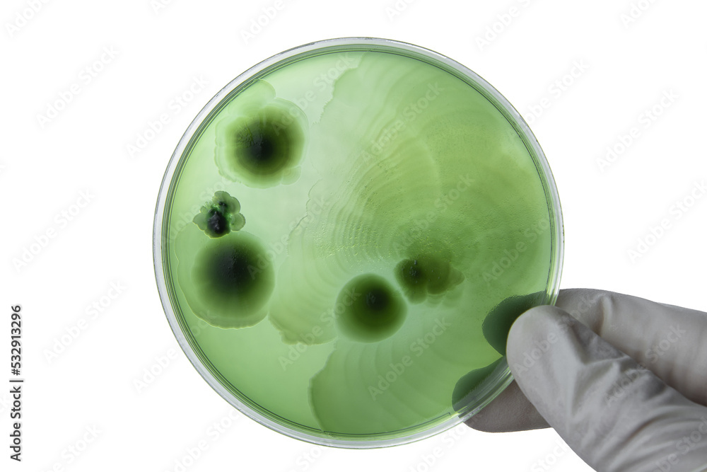 Hand with Petri dish or culture media with bacteria on white background ...