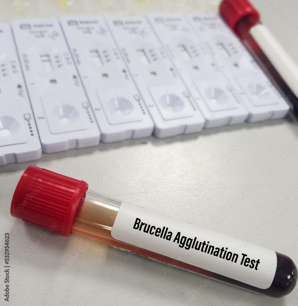 Blood sample for Brucella agglutination test to diagnosis of ...