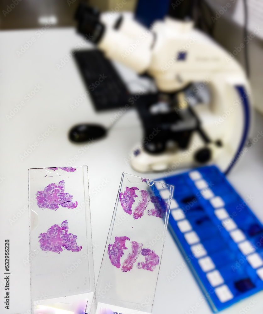 Close view of Histopathology slides stained with hematoxylin and eosin ...