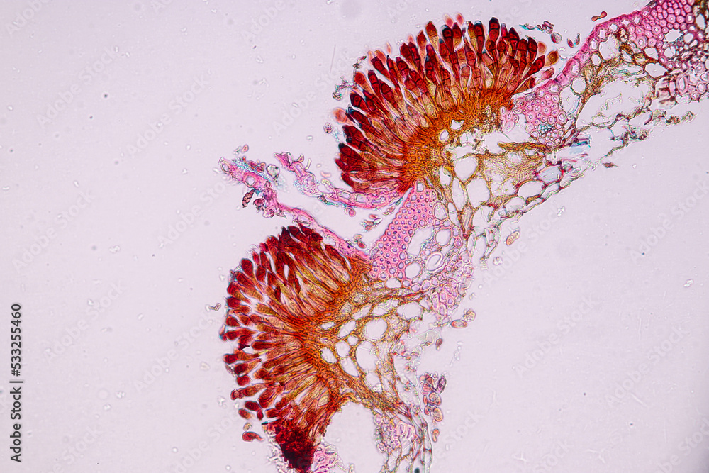 Plant tissue Structure, section (tissue) of stem plant tissue under a ...