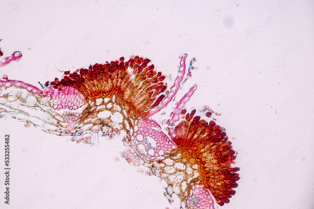 Plant tissue Structure, section (tissue) of stem plant tissue under a ...