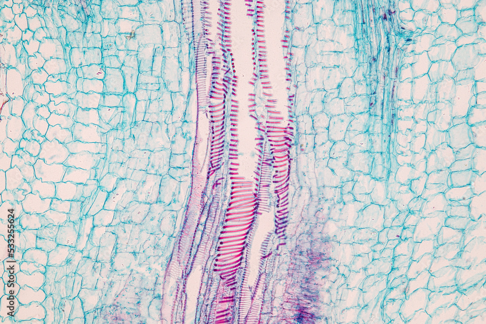 Plant tissue Structure, section (tissue) of stem plant tissue under a ...