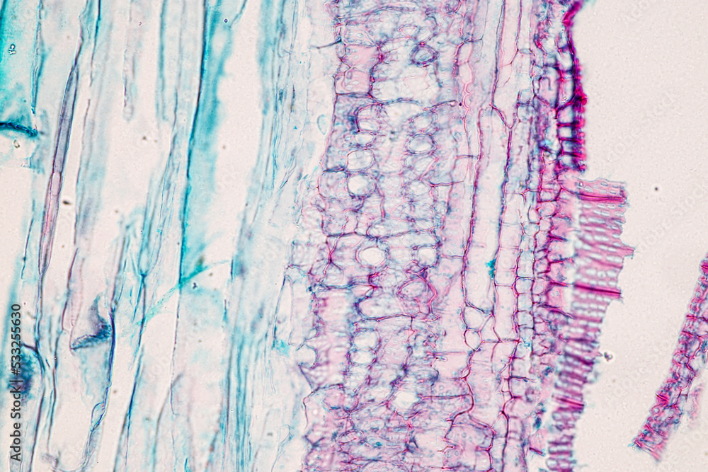 Plant tissue Structure, section (tissue) of stem plant tissue under a ...