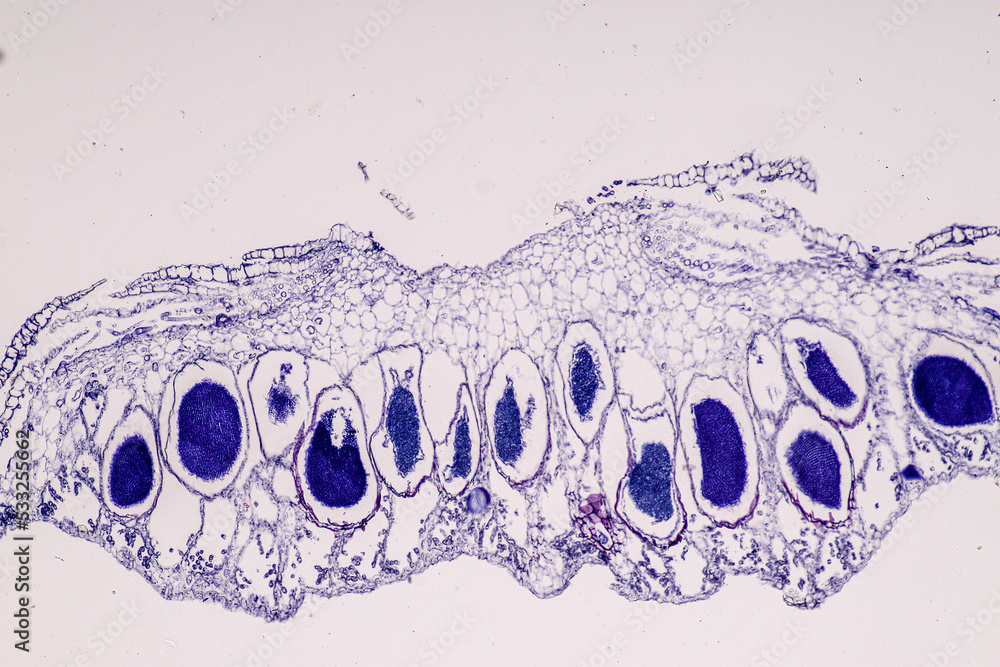 Plant tissue Structure, section (tissue) of stem plant tissue under a ...