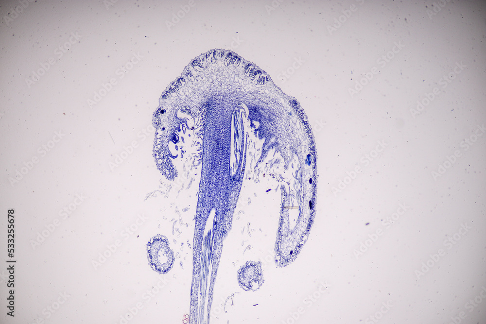 Plant tissue Structure, section (tissue) of stem plant tissue under a ...