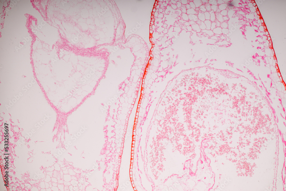 Plant tissue Structure, section (tissue) of stem plant tissue under a ...