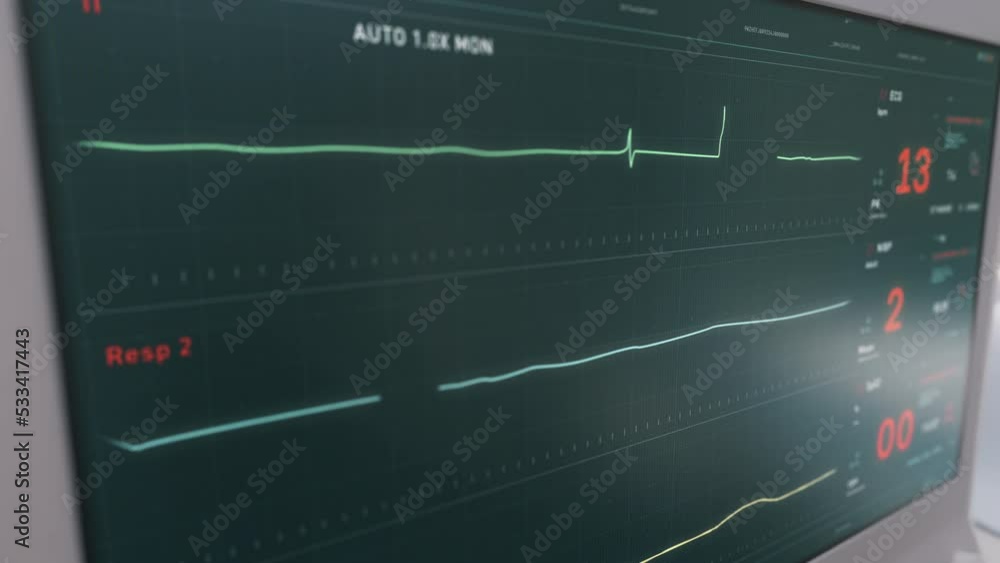 Cardiac Monitoring Hospital Device Displays Revival Of Patient Vital ...