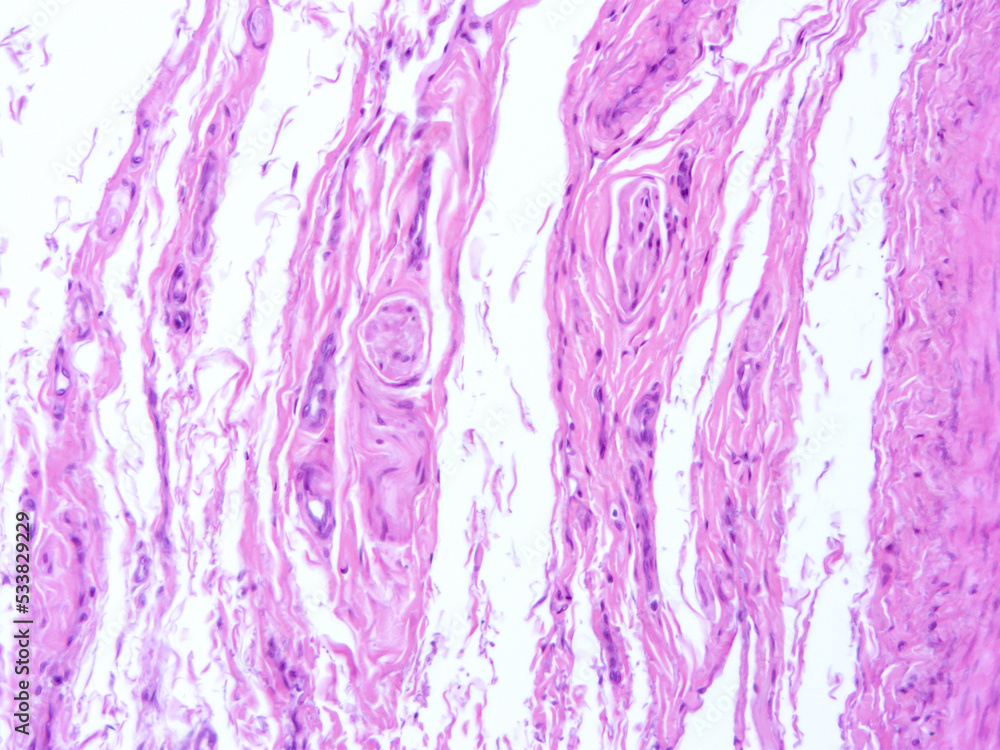 Histology of human tissue, show epithelial tissue and connective tissue ...