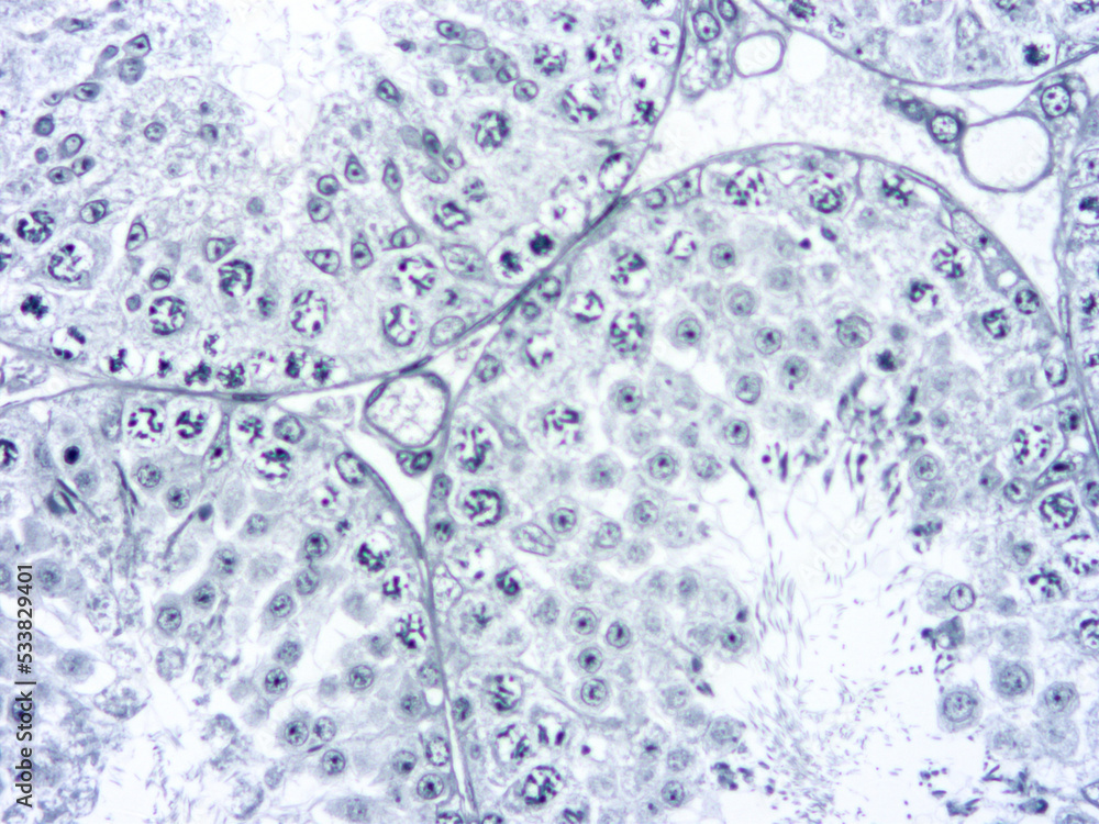 Histology of human tissue, show epithelial tissue and connective tissue ...