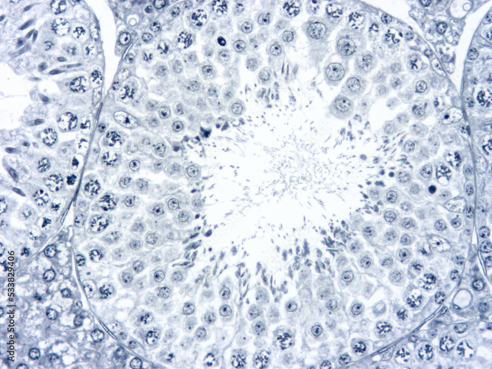 Histology of human tissue, show epithelial tissue and connective tissue ...