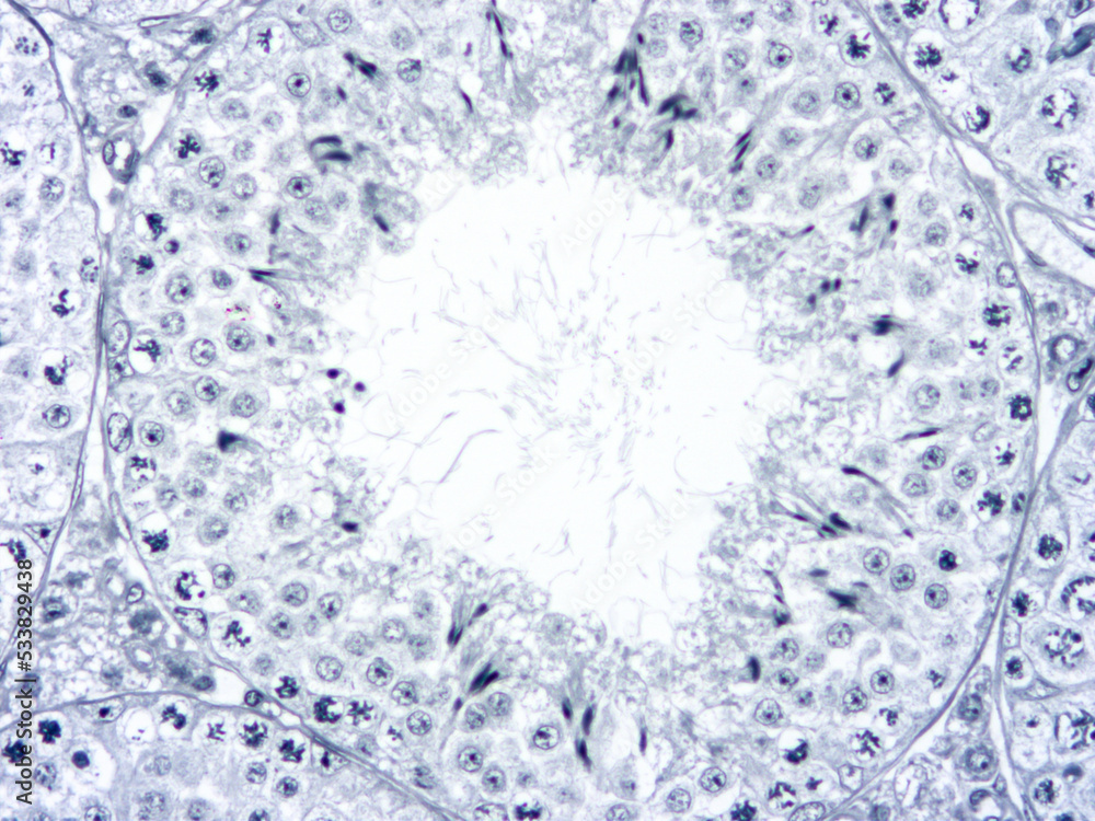 Histology of human tissue, show epithelial tissue and connective tissue ...