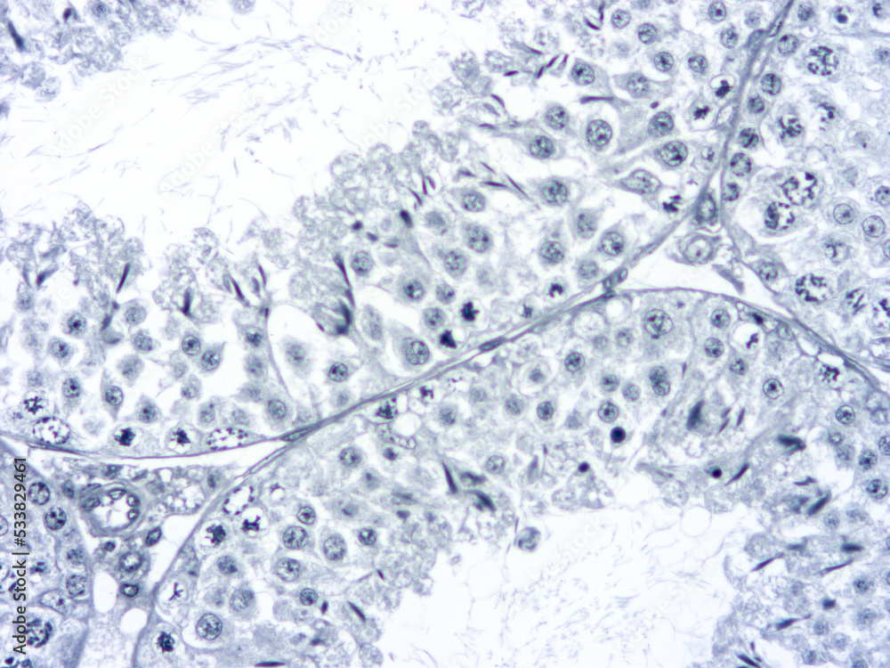 Histology of human tissue, show epithelial tissue and connective tissue ...