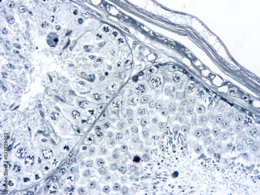 Histology of human tissue, show epithelial tissue and connective tissue ...
