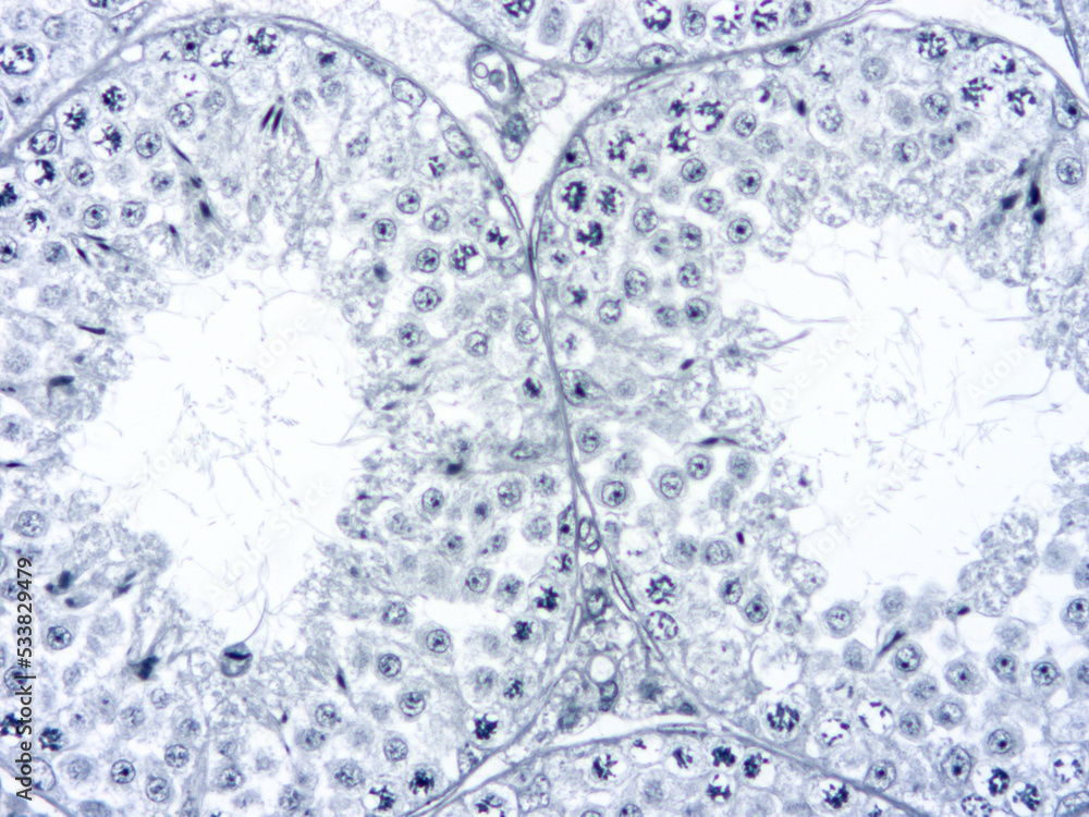 Histology of human tissue, show epithelial tissue and connective tissue ...