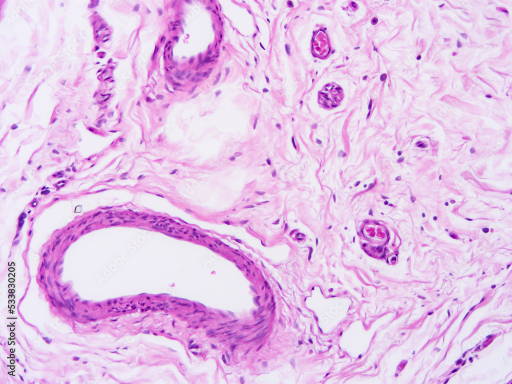 Histology of human tissue, show epithelial tissue and connective tissue ...