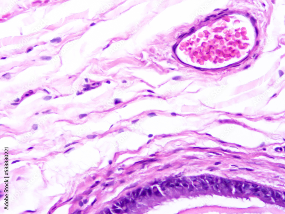 Histology of human tissue, show epithelial tissue and connective tissue ...