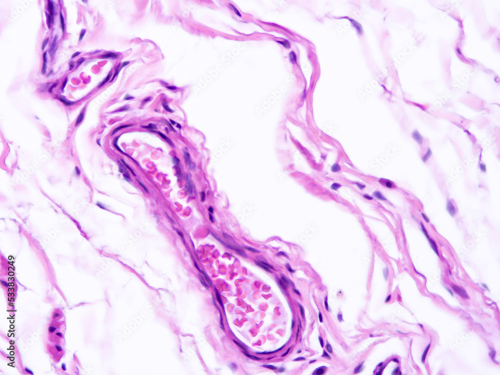Histology of human tissue, show epithelial tissue and connective tissue ...