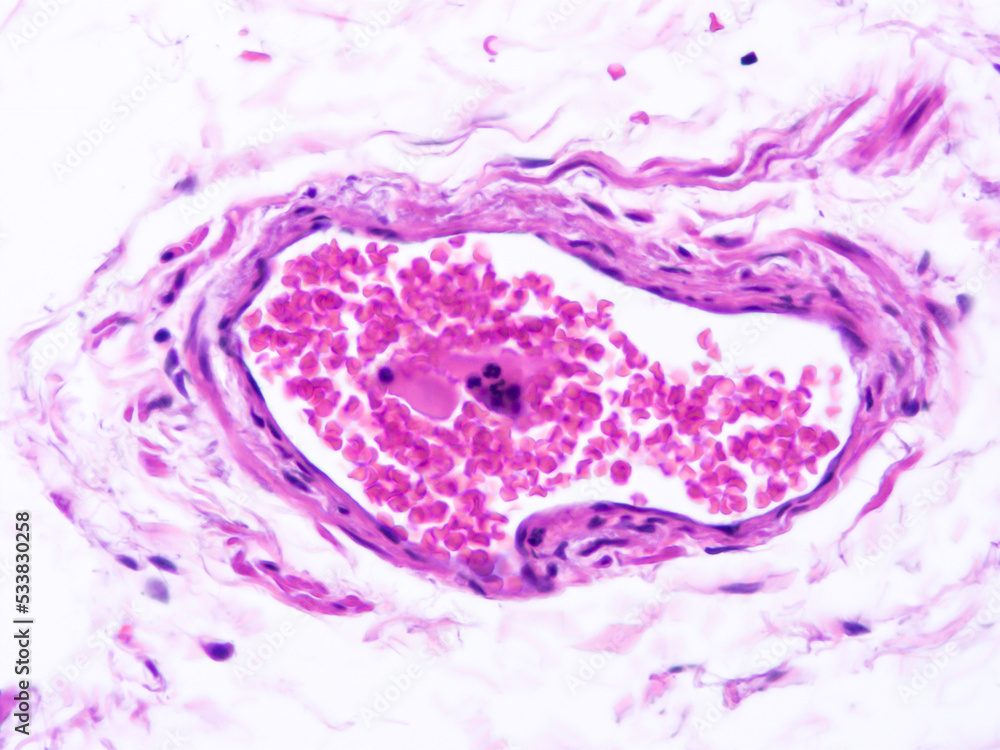 Histology of human tissue, show epithelial tissue and connective tissue ...