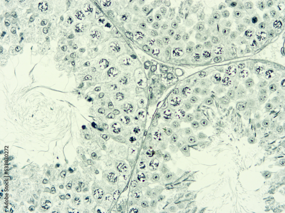 Histology of human tissue, show epithelial tissue and connective tissue ...