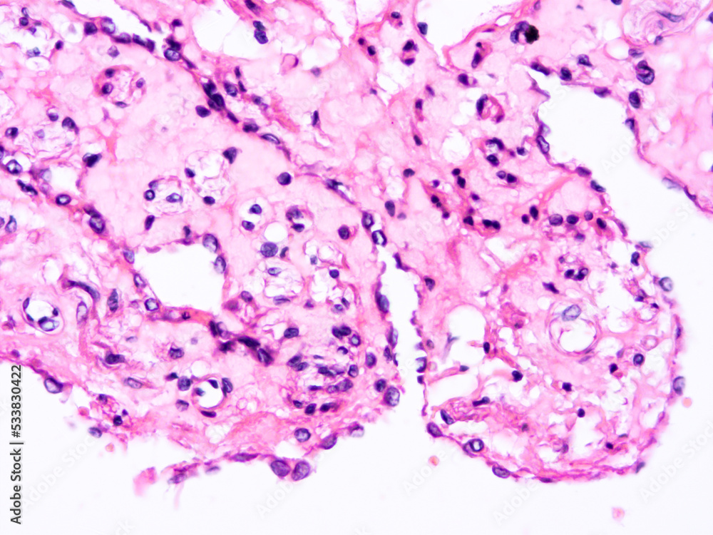 Histology of human tissue, show epithelial tissue and connective tissue ...