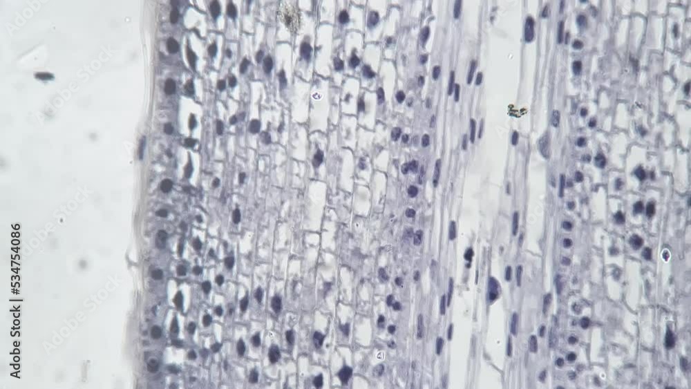 Root tip of Allium cepa in longitudinal section magnified by microscope ...