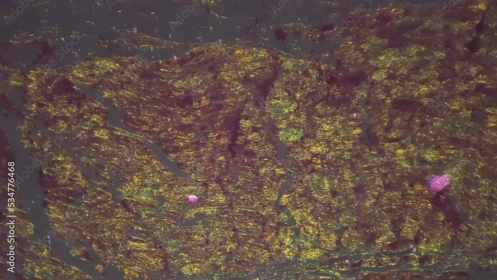 Macro slide of stratified squamous epithelium sec. magnified in 200 ...