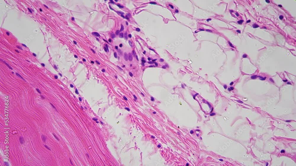 Stratified squamous epithelium in section filmed by microscope 400x ...