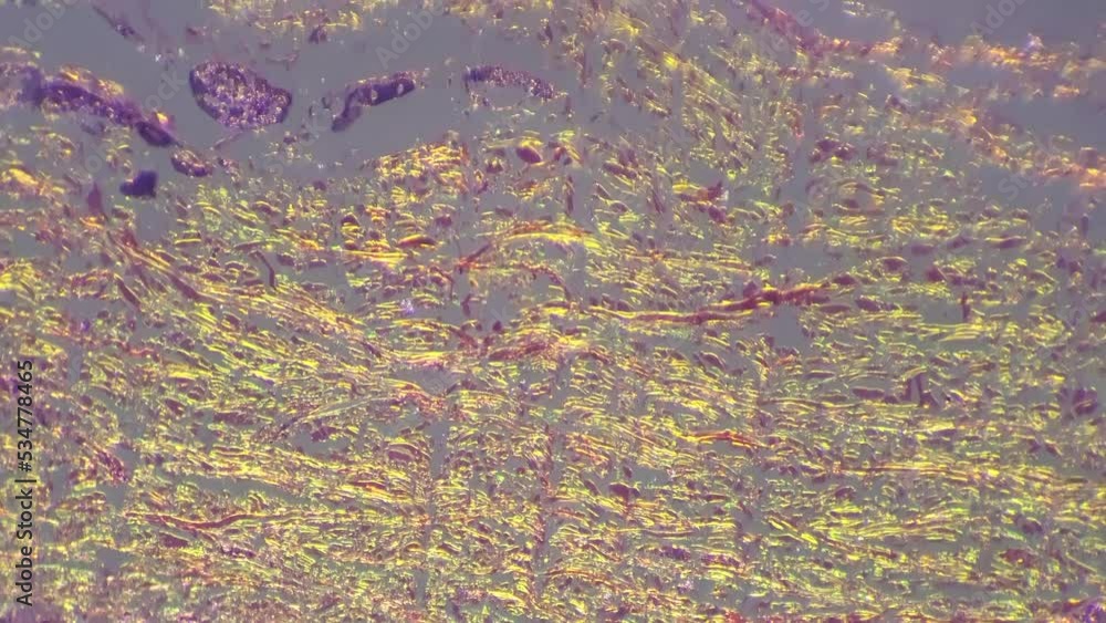 Sweat glands on human skin filmed under microscope 40x with cross light ...