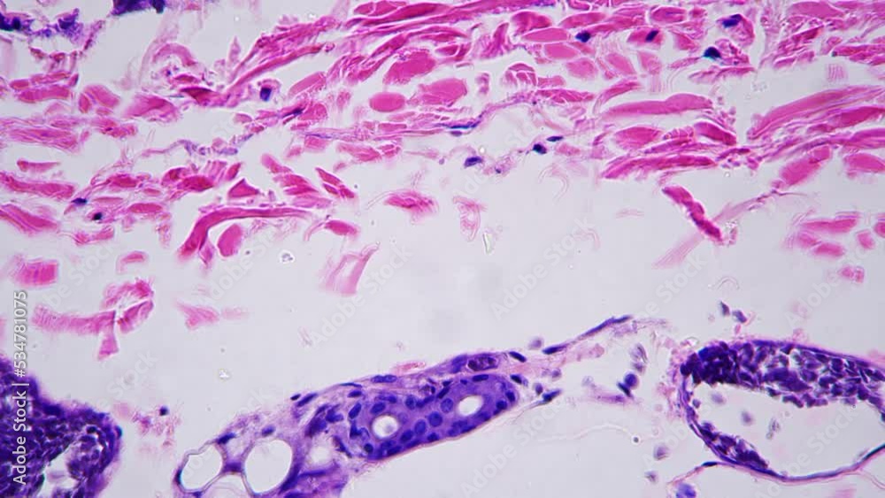 Microscopic 400x view of human skin with shown sweat glands against ...