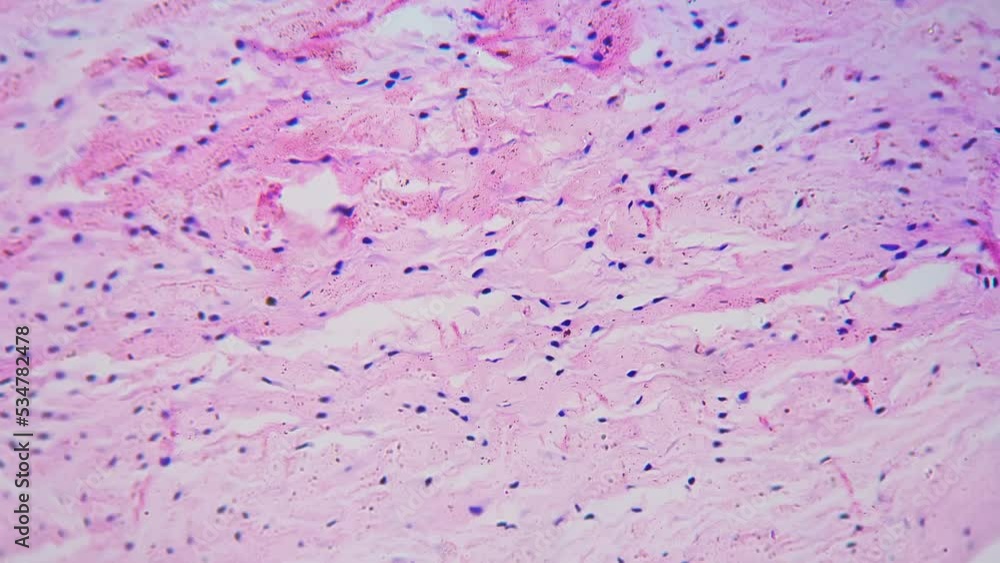 Dense connective tissue in longitudinal section under microscope 200x ...