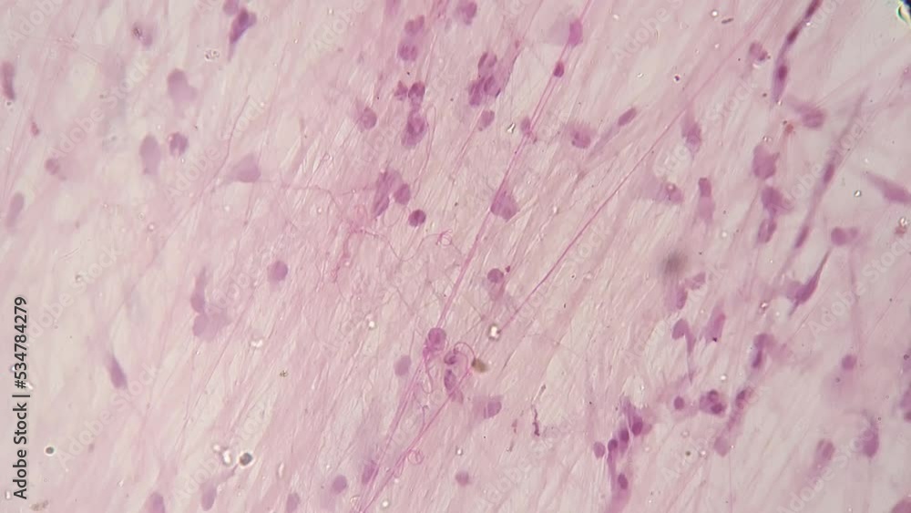 Loose connective tissue whole mount microscopic view with 200 times ...