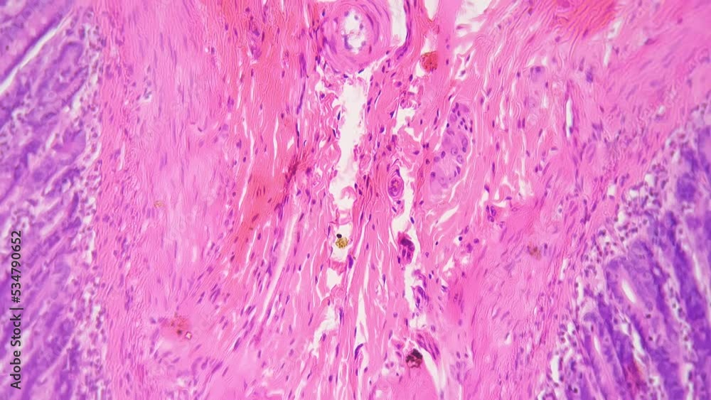 Smooth muscle isolated whole mount magnified by lab microscope in 200x ...