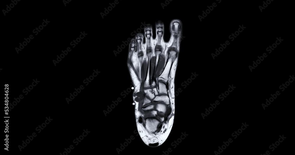 MRI foot scan for a diagnostic tool used to image the structures of the ...