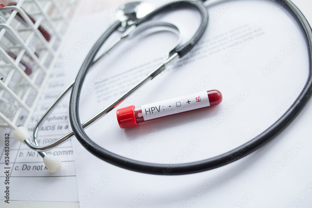 Laboratory - blood sample positive with HPV (human papilloma virus ...