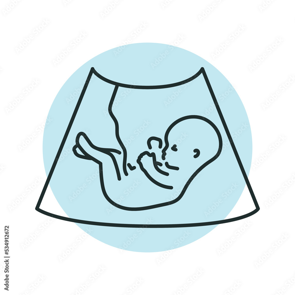 Ultrasound embryo color line illustration Stock Vector | Adobe Stock