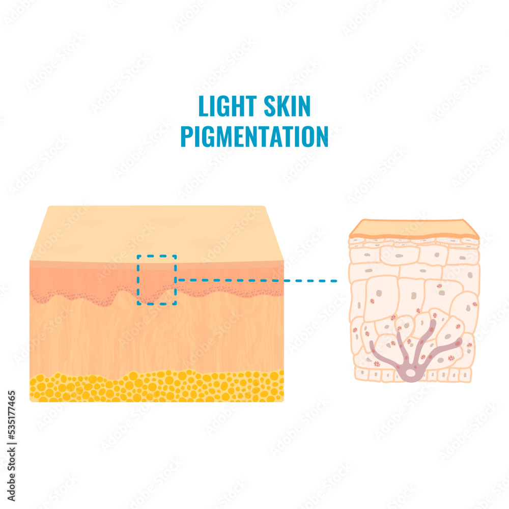 Melanin content and distribution in light skin. Fair complexion ...