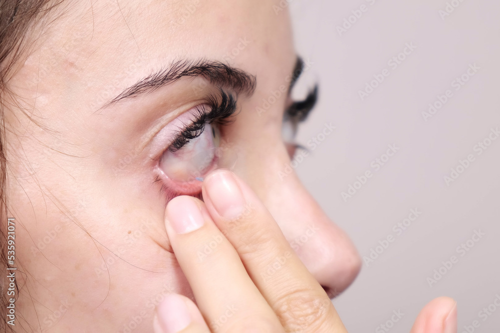 The Side View Inside Eye