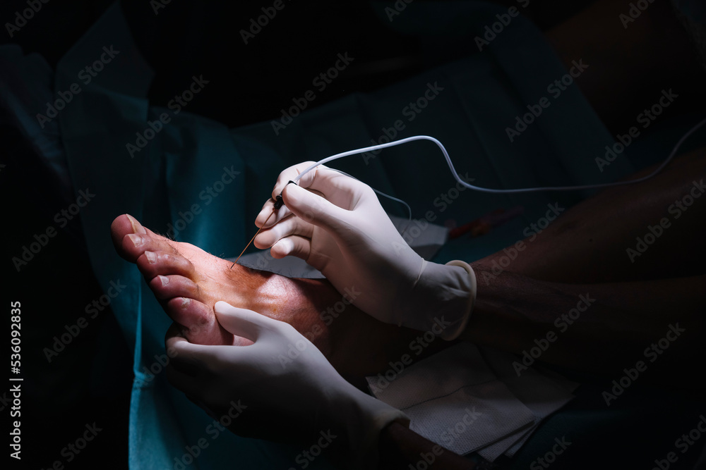 Crop hands inserting needle in patient feet Stock Photo | Adobe Stock