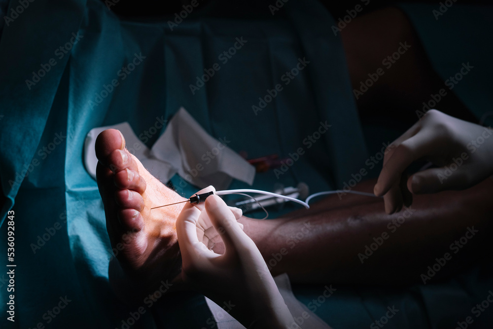 Crop hands inserting needle in patient feet Stock Photo | Adobe Stock