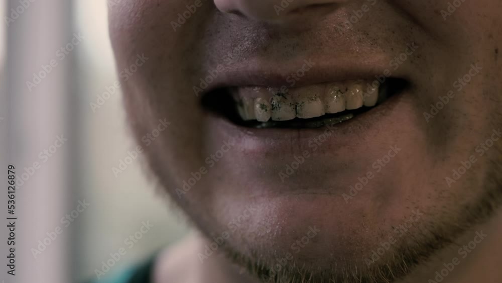 Terrible smile of a man with dirty teeth. Dental hygiene concept. Man ...