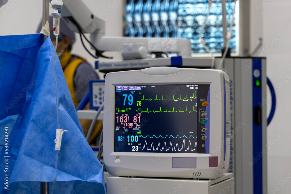 A monitor screen for a medical defibrillator or emergency heart pump ...
