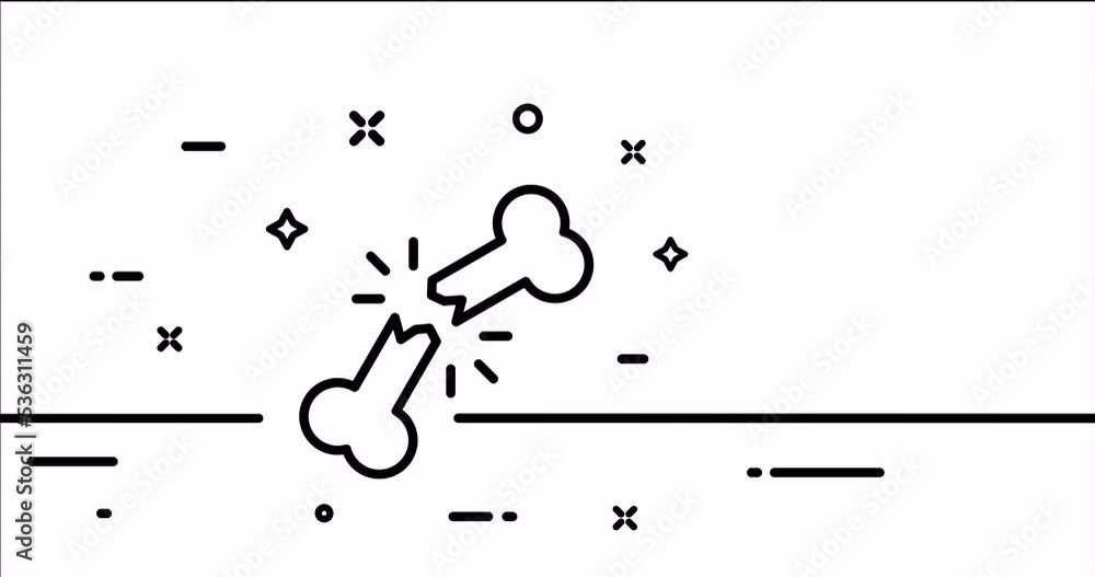 Broken bone. Open and closed fracture, limb, ribs, spine, skeleton ...