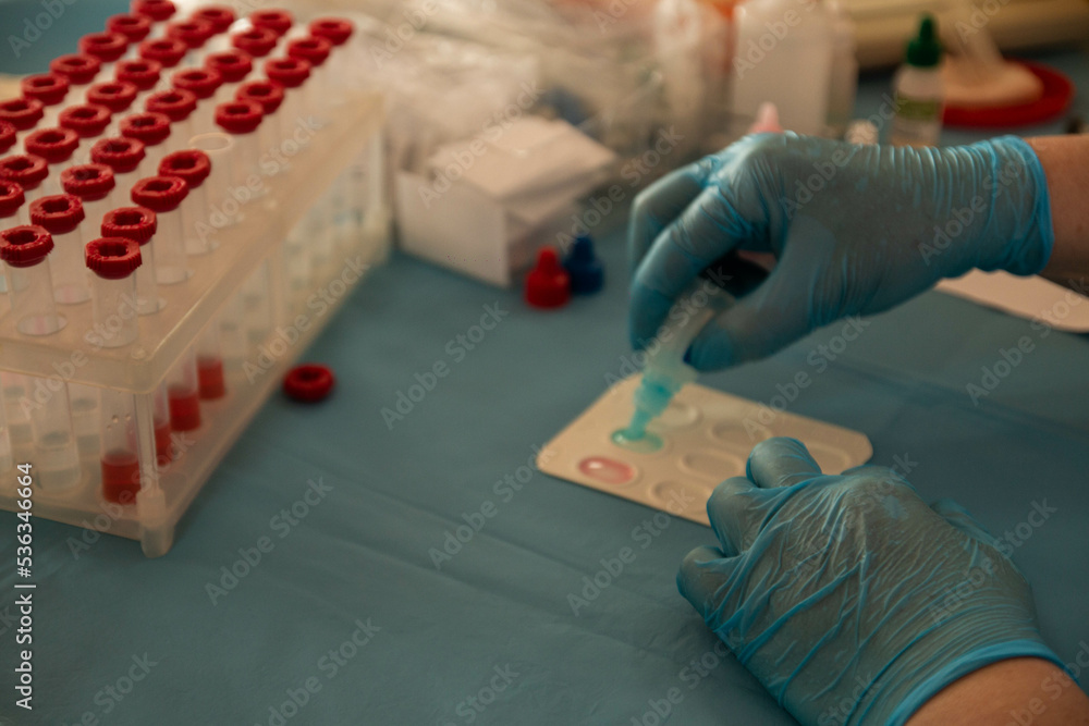 donor's day. a nurse in blue latex gloves takes a blood sample from a ...