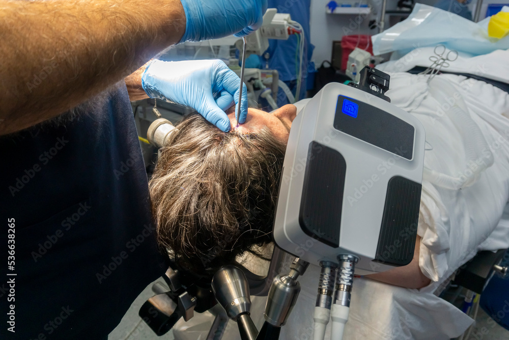 Step by step Visualase is an MRI-guided laser ablation system used to ...