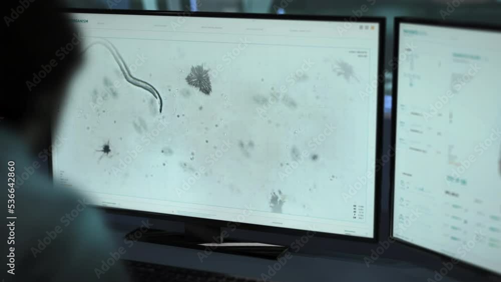 Doctor Using Medical Interface To Localise Parasitic Worm Inside Human ...