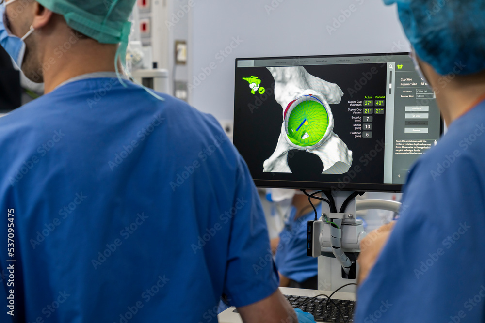 Team of doctor perform total hip arthroplasty replacement surgery in ...